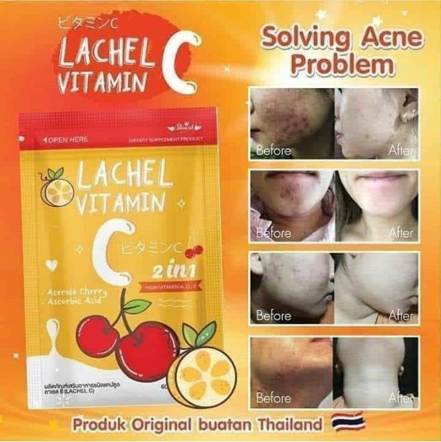 Lachel Vitamin C 60 Capsules – Kanna Beauty