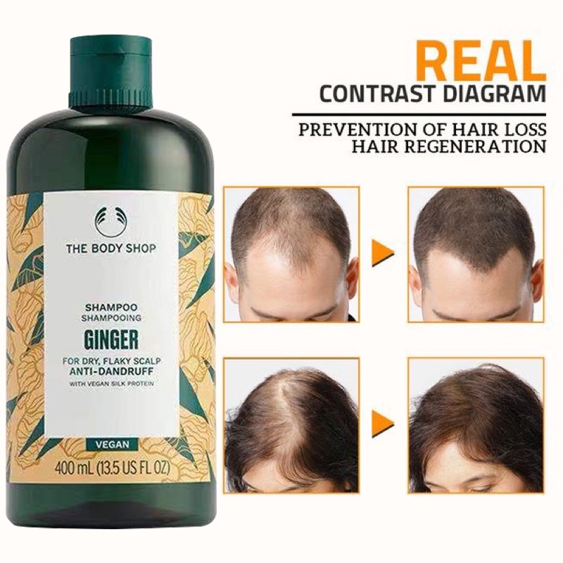 【COD】ljbbho6616664 The Body Shop Ginger Anti-Dandruff Shampoo 400ml anti Hair Loss Baldness ...