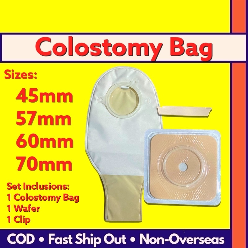 Share More Than 147 Colostomy Bag And Wafer Super Hot Stylex Vn