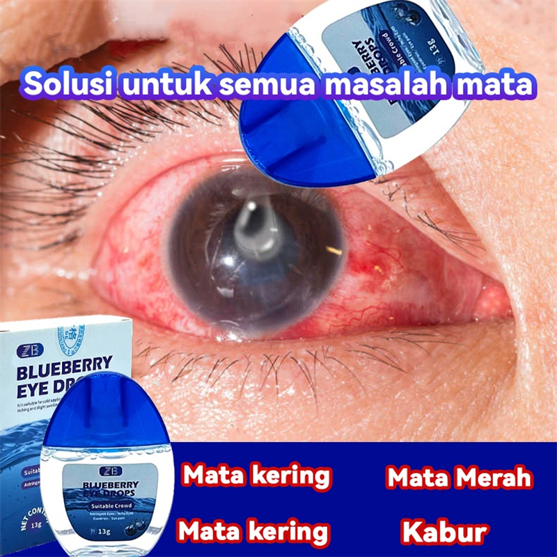 Buy Eyeberry Eye Drops online | Lazada.com.ph