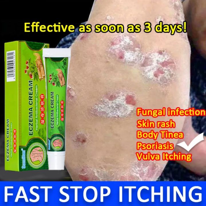 Shop Dermovate Oitnment online | Lazada.com.ph