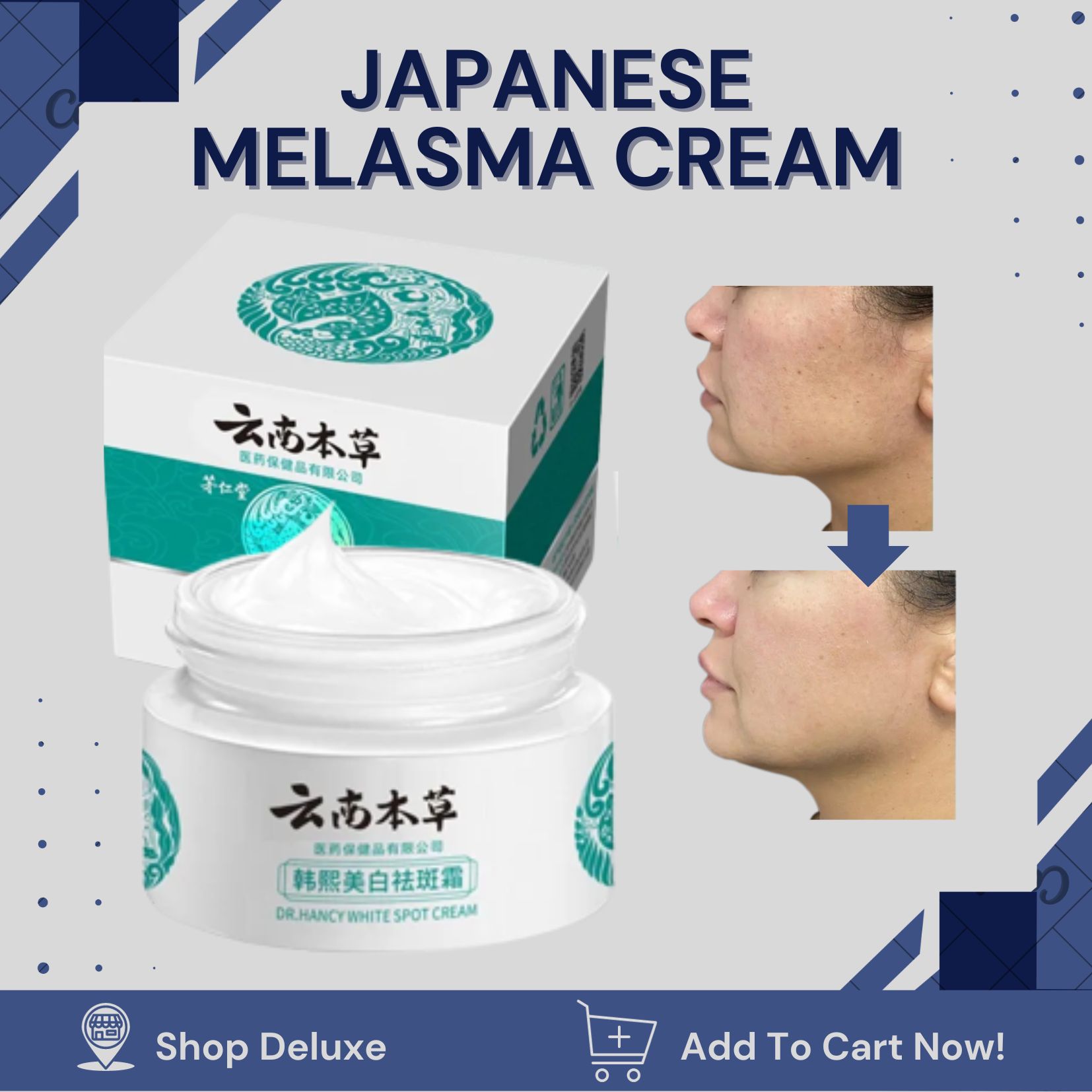 Shop Melasma Cream Pikas Remover with great discounts and prices online ...